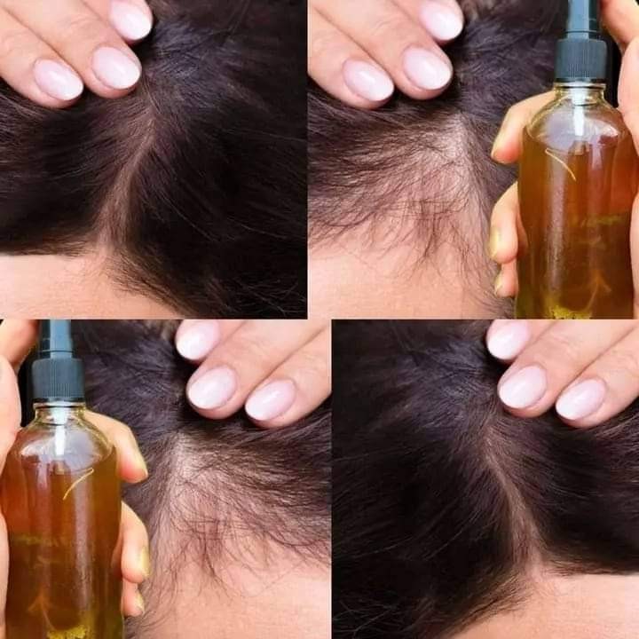 The Magic of Hair Oils: A Natural Solution for Hair Growth and Health ...